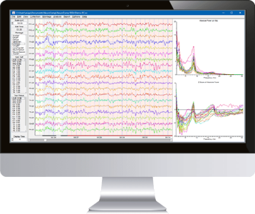نرم افزار NeuroGuide | NeuroShare