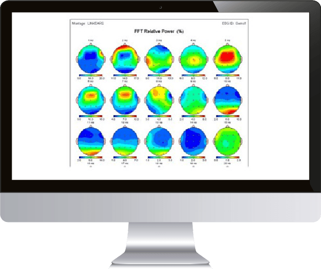 نرم افزار NeuroGuide | NeuroShare